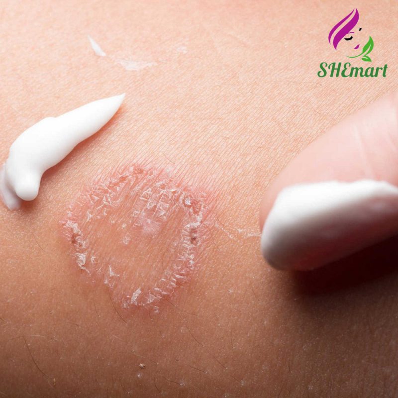 10 Tubes Silkron Cream 10g – Free ship - SHEmart Global