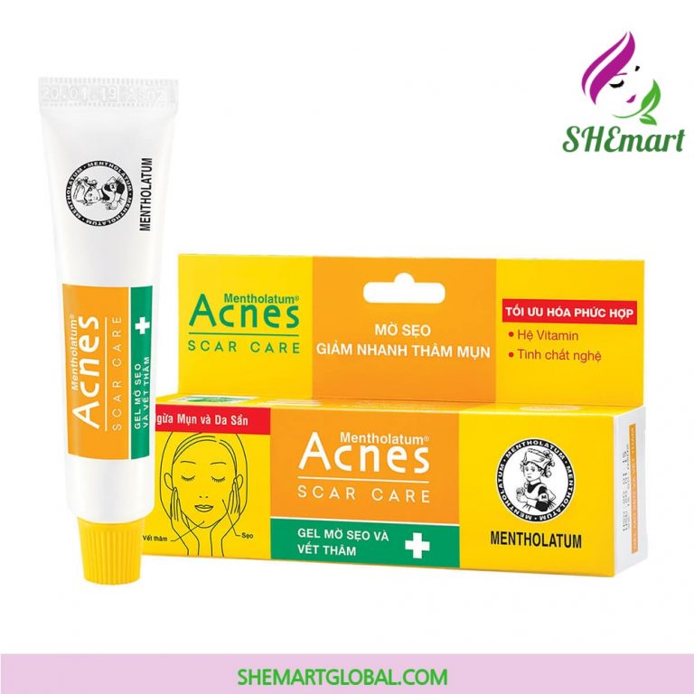 REVIEW SOSLAC G3 CREAM TREAT ALLERGIC SKIN - SHEmart Global